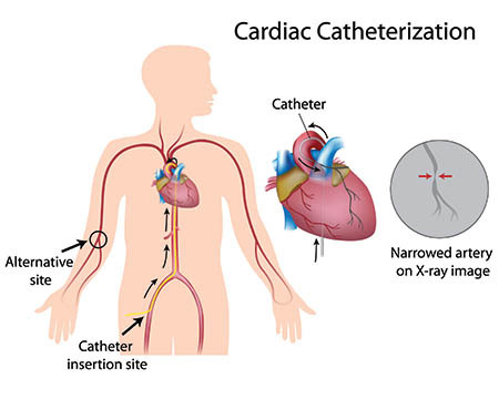 Columbus Vascular Center | Cardiac Services
